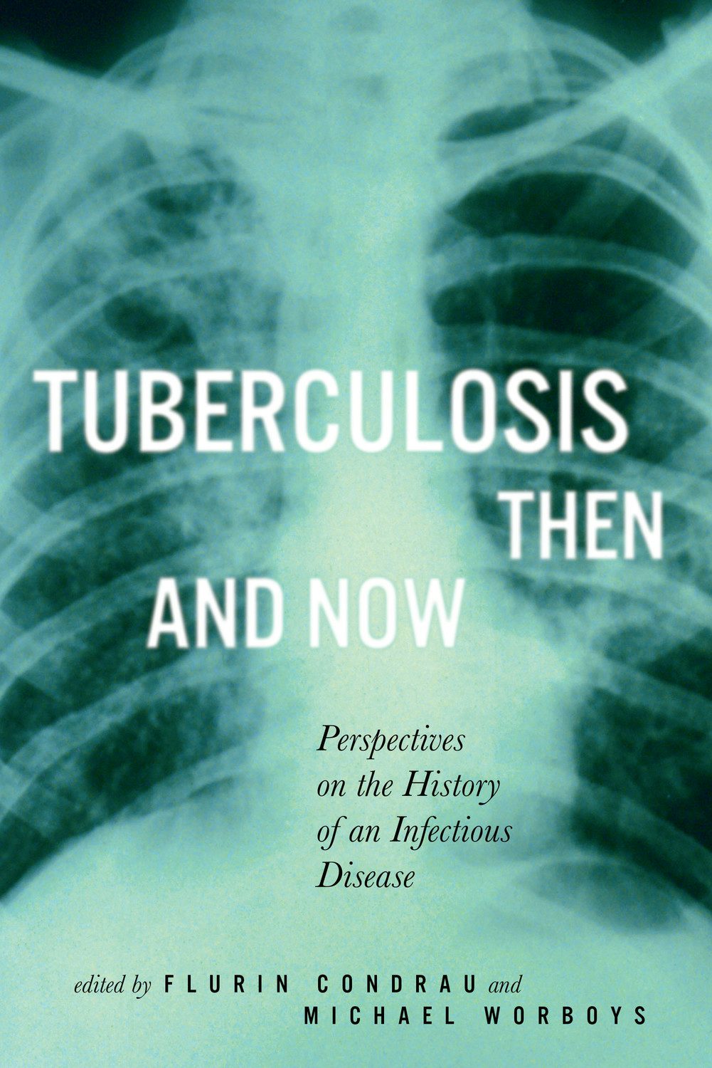 Tuberculosis Then and Now- Combined Academic